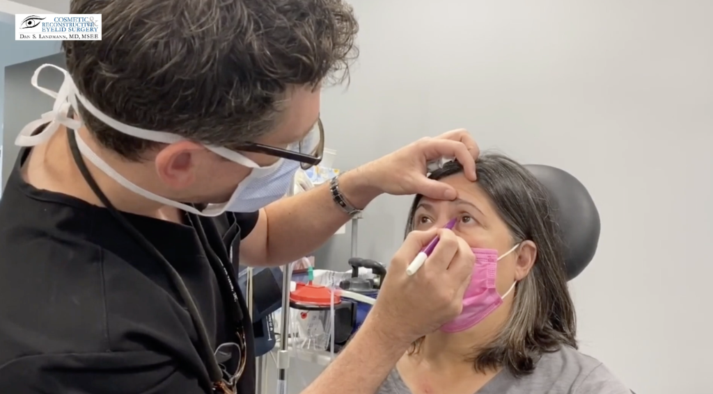Leading Expert Blepharoplasty in Washington Township, NJ